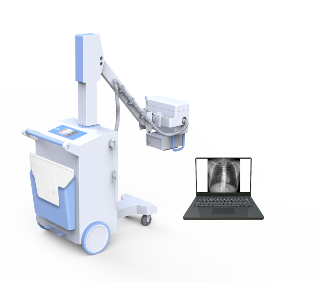 PLX5100 Mobile Digital Radiography System – Advanzo Equipments